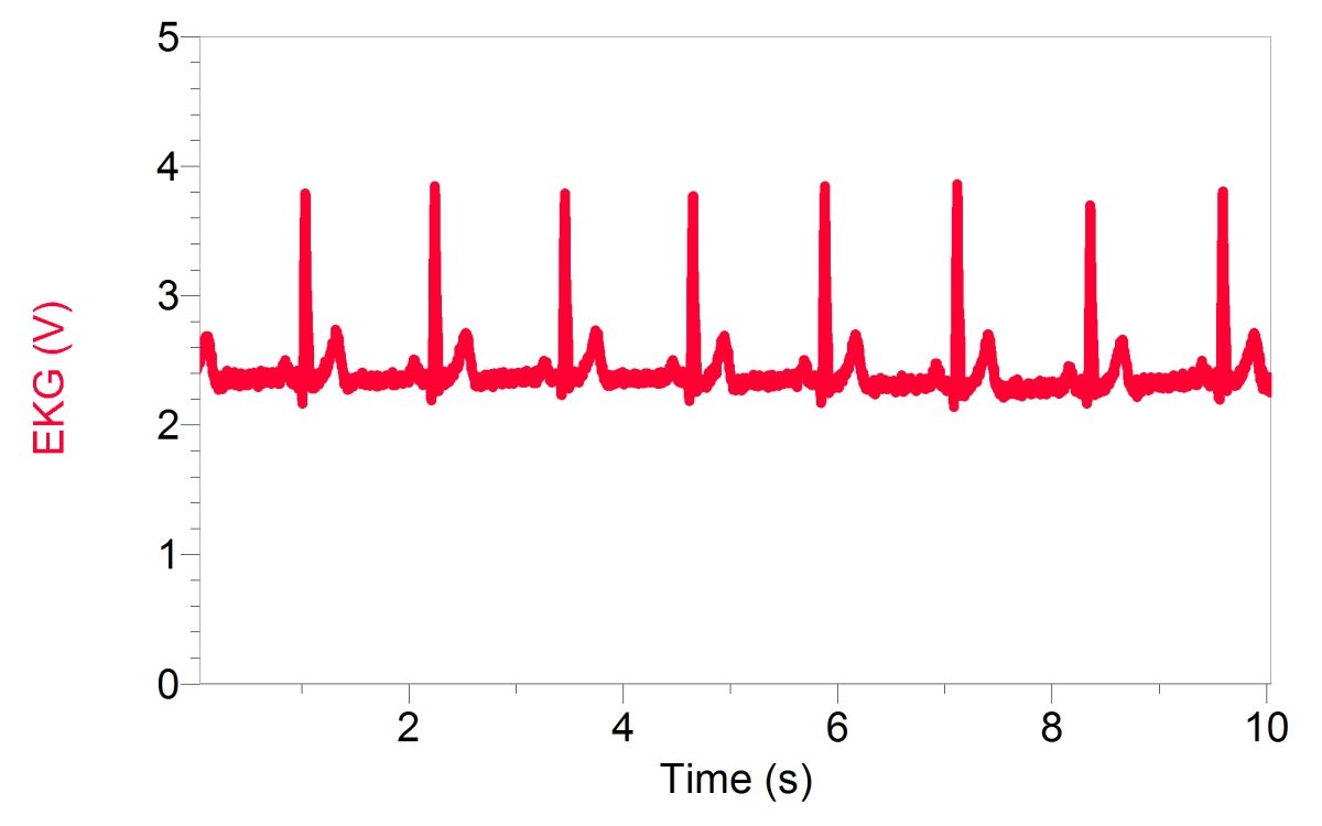 Vernier Qubit S207 EKG-Sensor (Q-S207) ECG/EMG-Sensor kabelgebunden ...